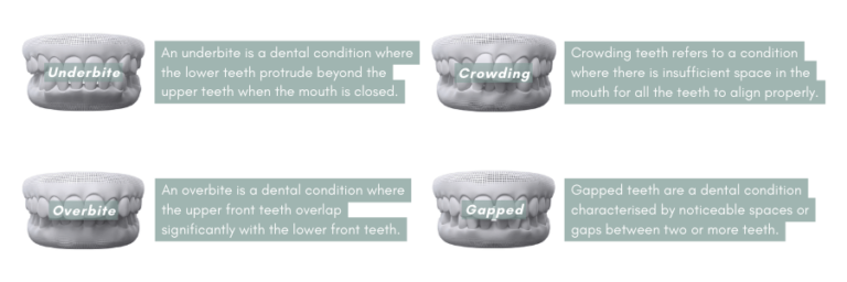 Can Adults and Children Use Invisalign? | Boroughbridge dental